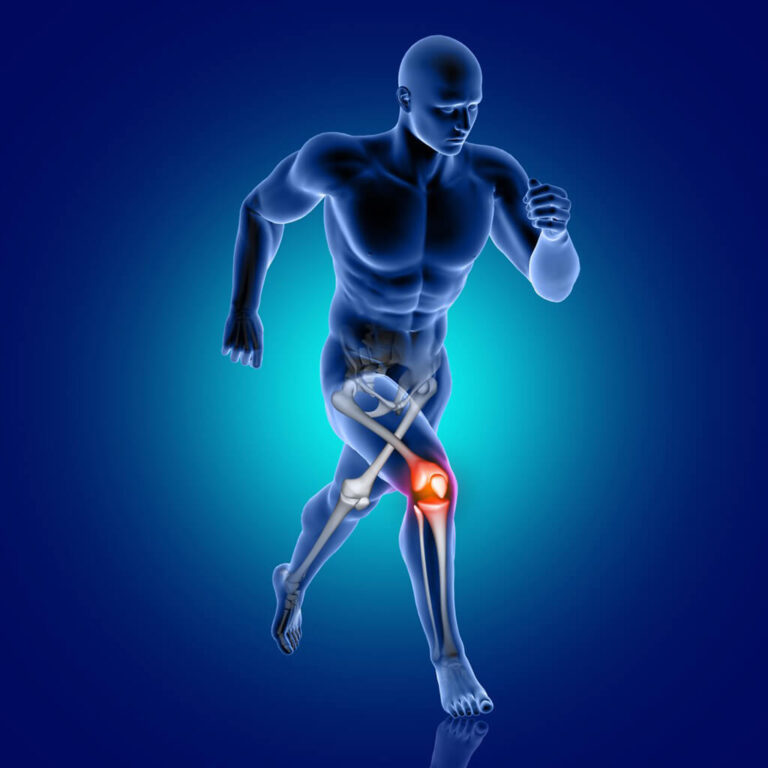 ¿En qué consiste la cirugía de rodilla por lesión de cartílago? - Costa ...